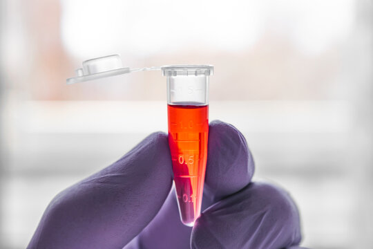 "Eppendorf Tube" Billeder – Gennemse 1,452 stockfotos, vektorer og ...