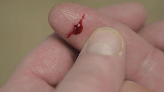 Paper Cut Injury