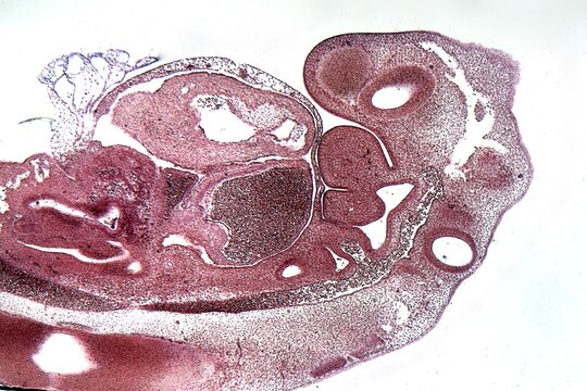 「Piggish」の写真素材 | 7,159件の無料イラスト画像 | Adobe Stock