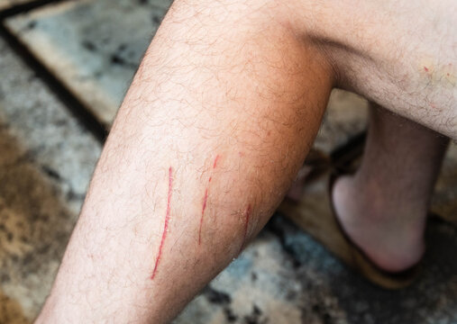 "Cat Attack" Images – Browse 65 Stock Photos, Vectors, and Video ...