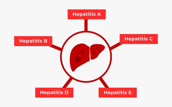 Hepatitis E Symptoms