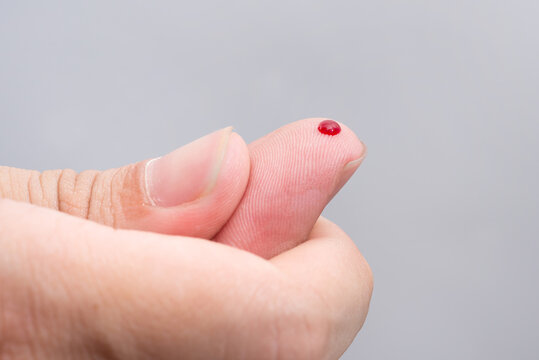 Imágenes de Dextrostix: descubre bancos de fotos, ilustraciones ...