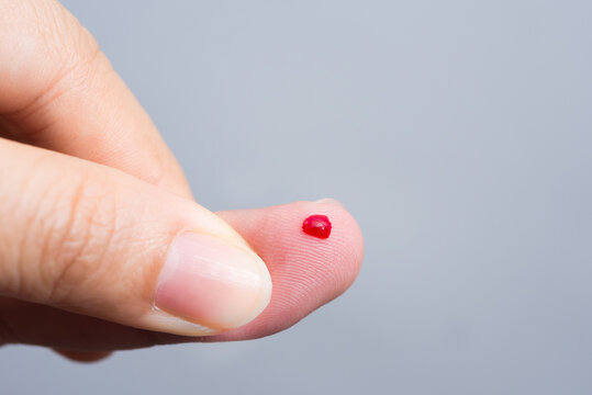 Imagens de Dextrostix – Explore Fotografias do Stock, Vetores e Vídeos ...