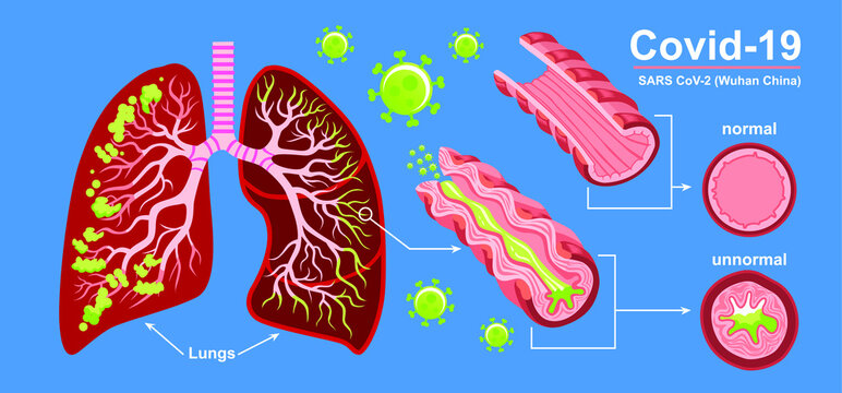 Mucus Bilder – Durchsuchen 36,959 Archivfotos, Vektorgrafiken und ...
