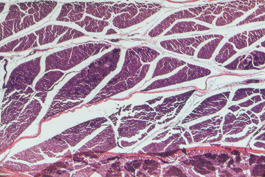 รูปภาพMyocard – เลือกดูภาพถ่ายสต็อก เวกเตอร์ และวิดีโอ9,437 | Adobe Stock