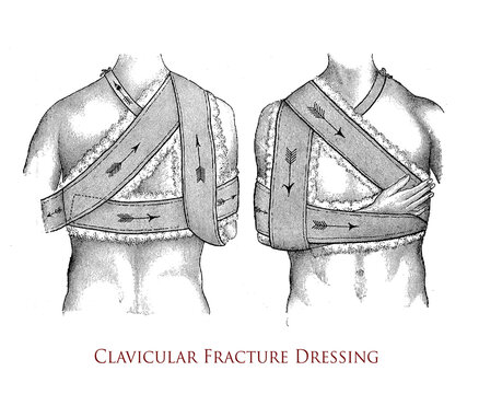 รูปภาพClavicular – เลือกดูภาพถ่ายสต็อก เวกเตอร์ และวิดีโอ220 | Adobe Stock