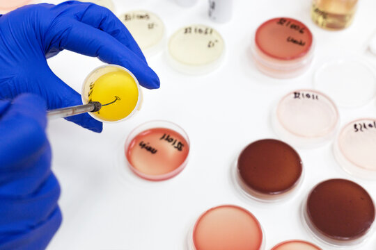 Urinprobe-Bilder: Stock-Fotos & -Videos. | Adobe Stock