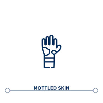 "Mottled Skin" Images – Browse 249 Stock Photos, Vectors, and Video ...