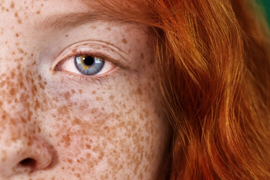 รูปภาพFreckle – เลือกดูภาพถ่ายสต็อก เวกเตอร์ และวิดีโอ204,284 | Adobe Stock