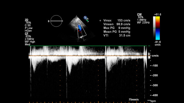 รูปภาพCusp – เลือกดูภาพถ่ายสต็อก เวกเตอร์ และวิดีโอ43,748 | Adobe Stock
