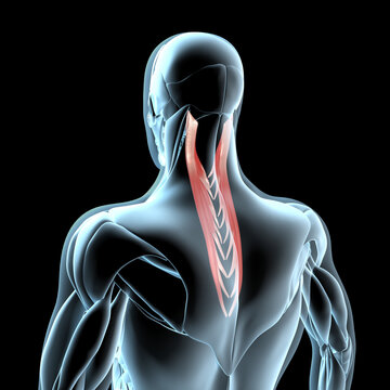 Splenius Capitis Muscle Pain