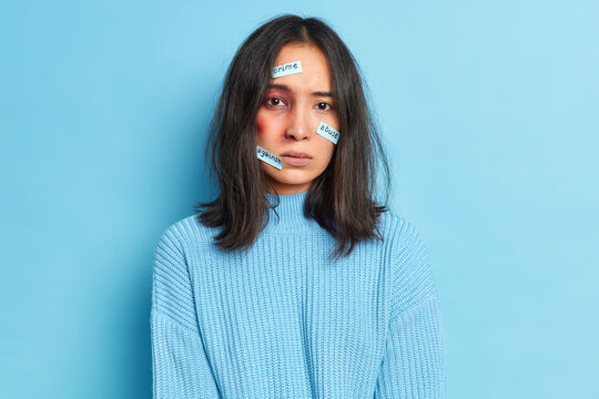 Beat Up Face Bilder – Durchsuchen 19,289 Archivfotos, Vektorgrafiken ...