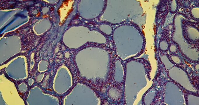 Colloid bilder – Bläddra bland 2,447 stockfoton, vektorer och videor ...