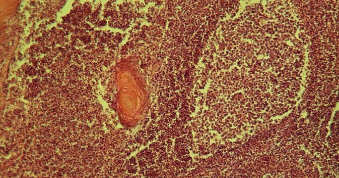 Gaumenmandeln Bilder – Durchsuchen 314 Archivfotos, Vektorgrafiken und ...