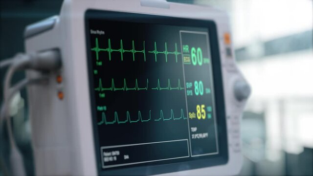 "Cardiac Monitor" Images – Browse 11,822 Stock Photos, Vectors, and ...