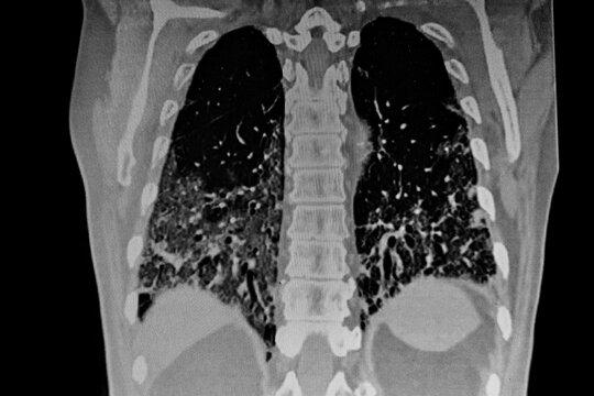 รูปภาพGgo – เลือกดูภาพถ่ายสต็อก เวกเตอร์ และวิดีโอ179 | Adobe Stock