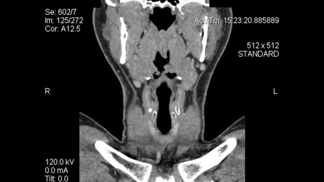 "Coronal Section" Images – Browse 607 Stock Photos, Vectors, and Video ...