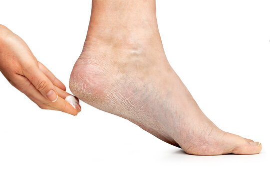 Callous Clipart Of Children