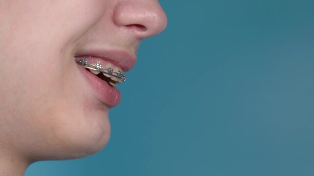 Snaggletooth Images – Browse 152 Stock Photos, Vectors, and Video ...