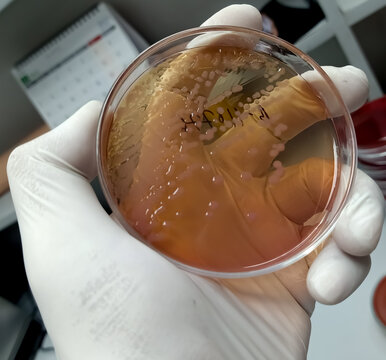 รูปภาพPseudomonas – เลือกดูภาพถ่ายสต็อก เวกเตอร์ และวิดีโอ1,667 | Adobe ...