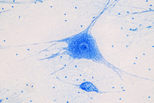 Human Nerve Cell Under Microscope