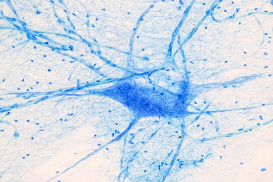 Neurofibrils