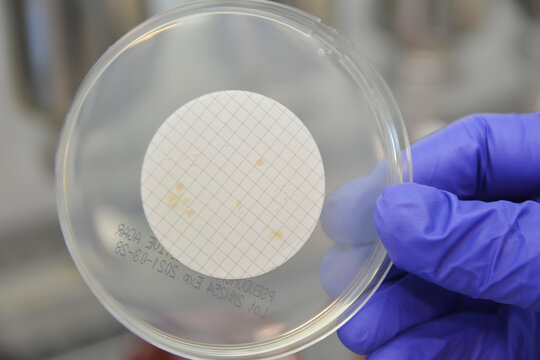 Pseudomonas Aeruginosa Images Browse 846 Stock Photos Vectors And