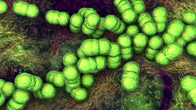 รูปภาพImpetigo – เลือกดูภาพถ่ายสต็อก เวกเตอร์ และวิดีโอ921 | Adobe Stock