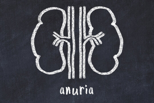 Anuria Images – Browse 31 Stock Photos, Vectors, and Video | Adobe Stock