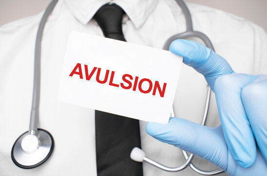 รูปภาพAvulsion – เลือกดูภาพถ่ายสต็อก เวกเตอร์ และวิดีโอ152 | Adobe Stock