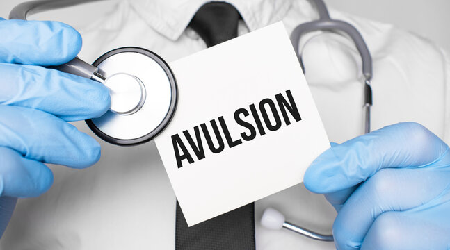 Avulsion bilder – Bläddra bland 152 stockfoton, vektorer och videor ...
