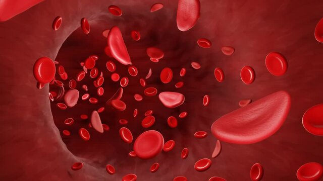 Sickle-Cell Images – Browse 28,333 Stock Photos, Vectors, and Video ...