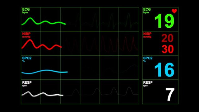 "Heart Rate Monitor" Images – Browse 10,099 Stock Photos, Vectors, and ...