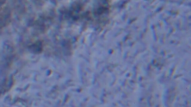 "Human Feces" Images – Browse 514 Stock Photos, Vectors, and Video ...