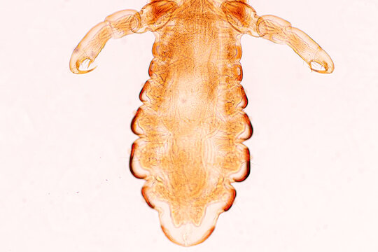 Pediculus Bilder – Durchsuchen 538 Archivfotos, Vektorgrafiken und ...