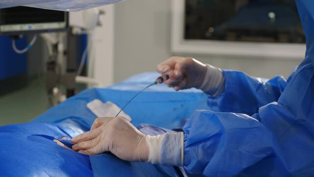 "Vascular Surgery" Images – Parcourir 1,072 le catalogue de photos ...