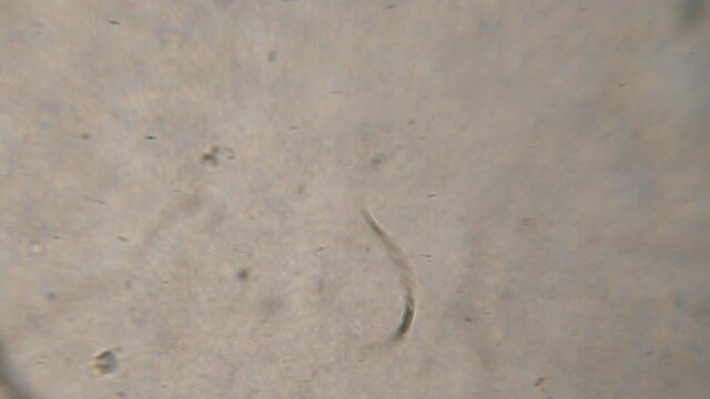 Roundworm Images – Browse 8,146 Stock Photos, Vectors, and Video ...