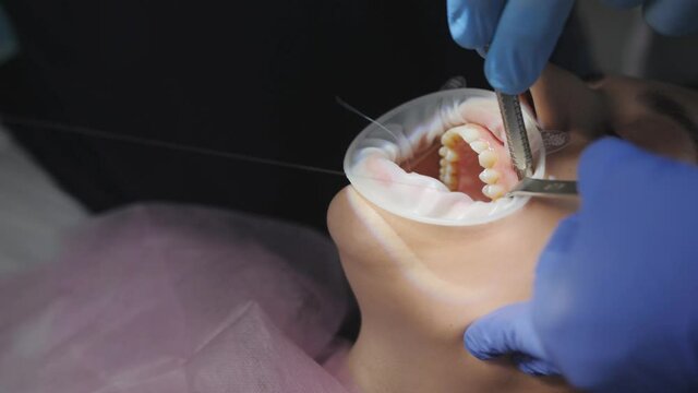 Odontectomy Images – Browse 6,958 Stock Photos, Vectors, and Video ...