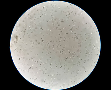 Spermogram bilder – Bläddra bland 306 stockfoton, vektorer och videor ...