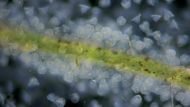 Oligohymenophorea Images – Browse 65 Stock Photos, Vectors, and Video ...