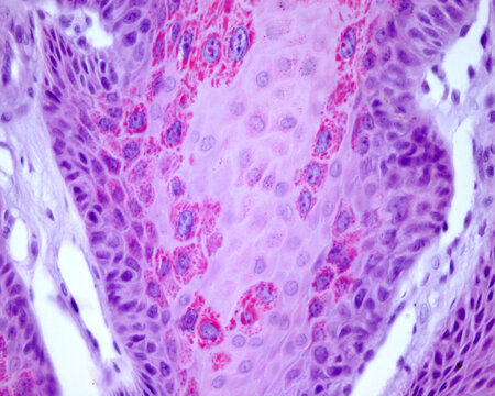 รูปภาพMolluscum – เลือกดูภาพถ่ายสต็อก เวกเตอร์ และวิดีโอ439 | Adobe Stock