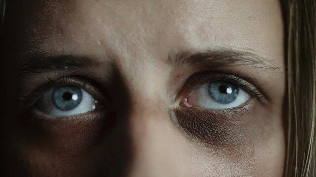 Beat Up Face Images – Browse 20,906 Stock Photos, Vectors, and Video ...