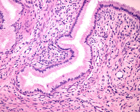 Zervix Bilder – Durchsuchen 13,816 Archivfotos, Vektorgrafiken und ...