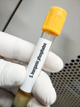 รูปภาพPhosphates – เลือกดูภาพถ่ายสต็อก เวกเตอร์ และวิดีโอ8,367 | Adobe ...