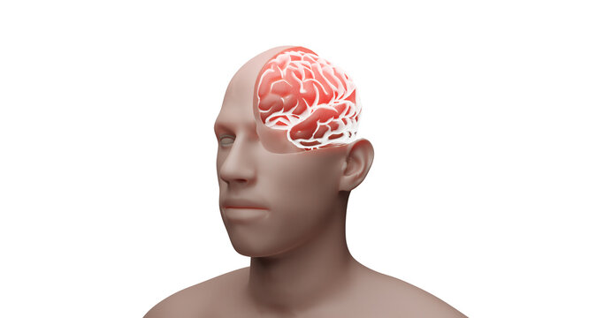 Lobotomy Before And After Brain