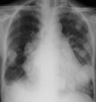 "Canon Ball" Images – Browse 120 Stock Photos, Vectors, and Video ...