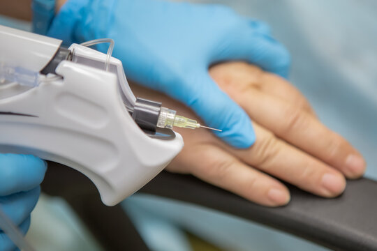 รูปภาพMicroinjection – เลือกดูภาพถ่ายสต็อก เวกเตอร์ และวิดีโอ154 ...