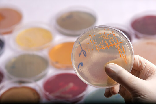 รูปภาพMicrococcus – เลือกดูภาพถ่ายสต็อก เวกเตอร์ และวิดีโอ793 | Adobe Stock