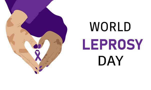 รูปภาพ"Leprosy – เลือกดูภาพถ่ายสต็อก เวกเตอร์ และวิดีโอ14,953 | Adobe Stock