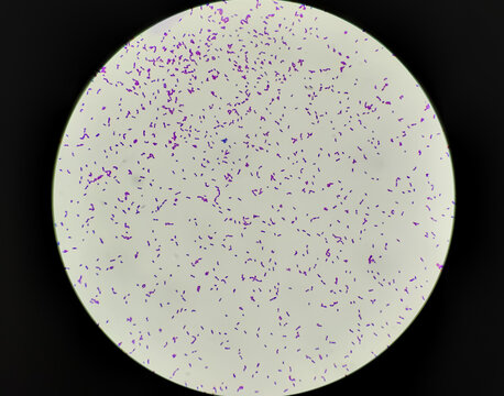 Enterococcus Faecalis Gram Stain